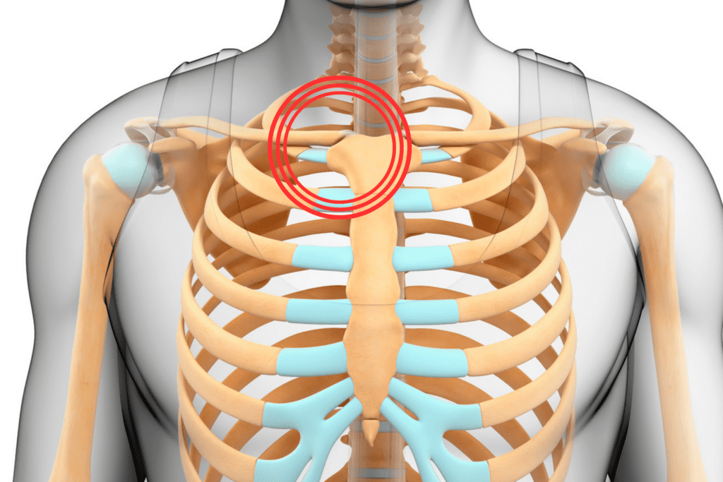 Sternoclavicular Joint Injuries - Understanding the Why